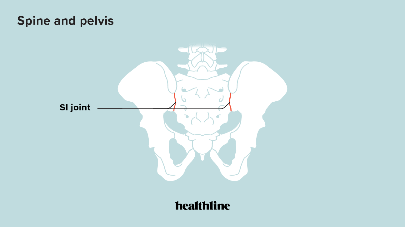 Sacroiliac Joint Injection Success Rate: How Well Does It Work?