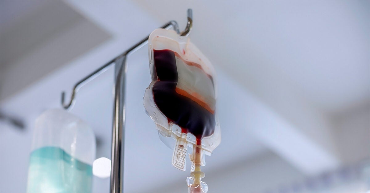 Blood Transfusions for Myelodysplastic Syndromes (MDS)