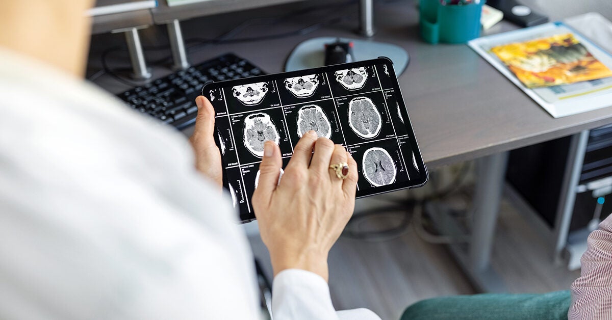 Brain Scans for Dementia: MRI, CT, and other Diagnostic Tools