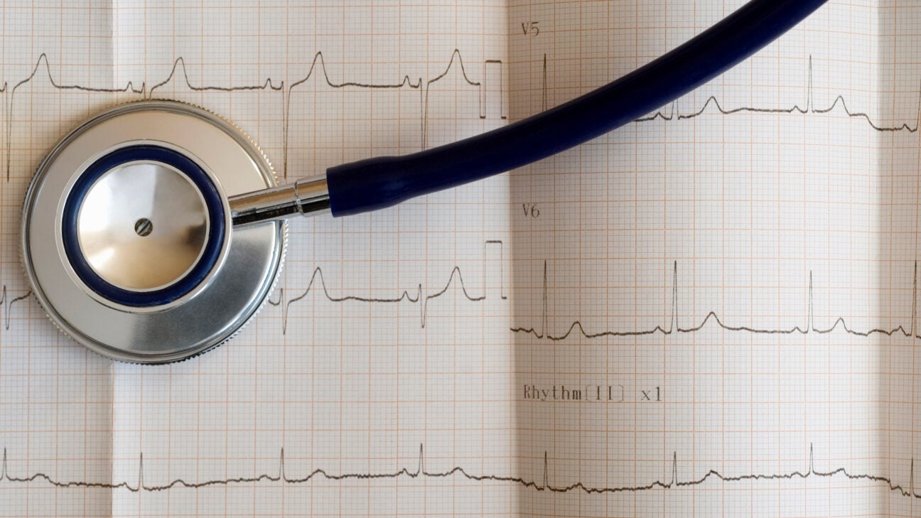  EKG vs 