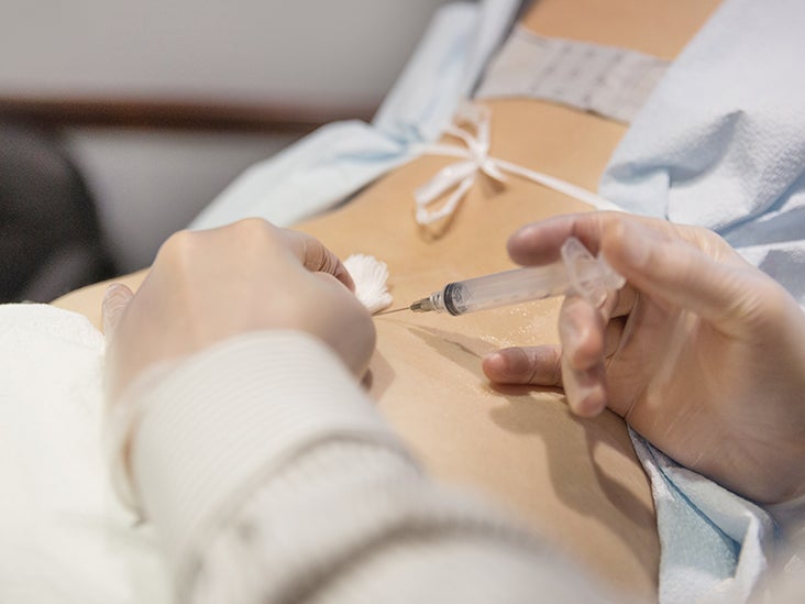 Types of Injections for Back Pain: Cortisone, Nerve Blocks, More