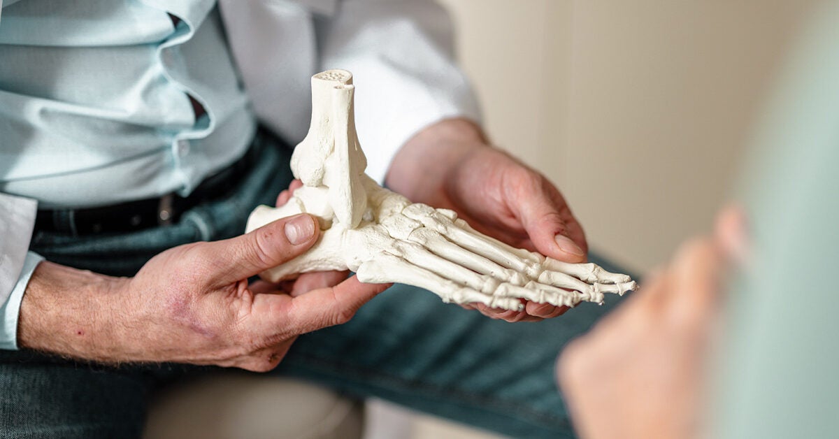 Keller's Arthroplasty: Procedure, Risks, and Effectiveness