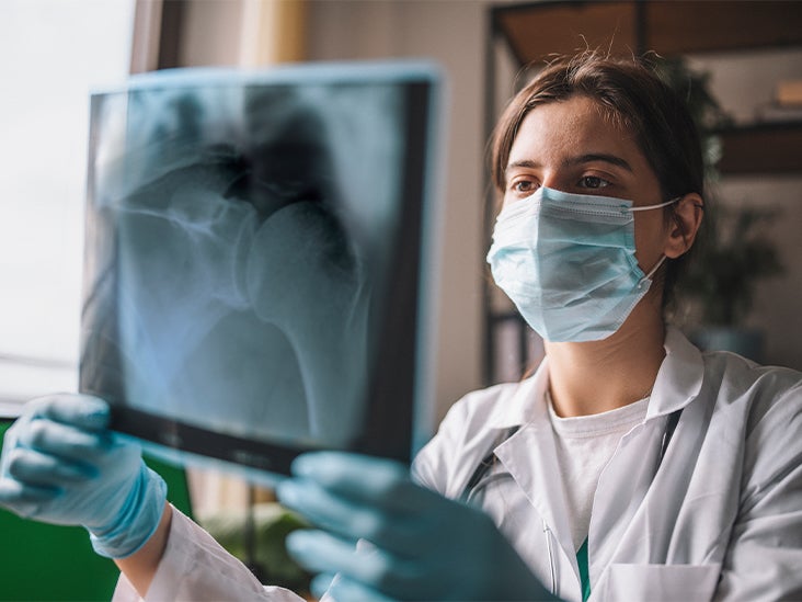 Acromioclavicular Joint Separation: Symptoms, Diagnosis, and Treatment