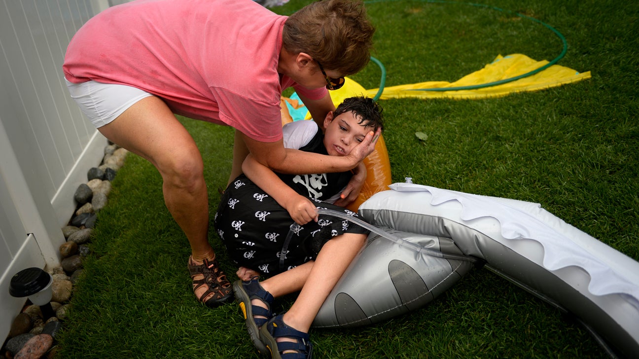 Clonic Seizures Symptoms Features Treatments