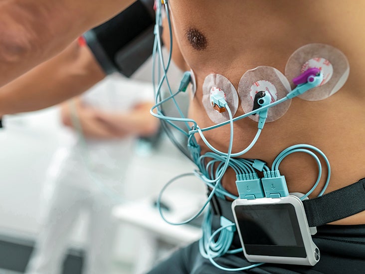 What Happens If You Fail A Stress Test Or Get Abnormal Result 