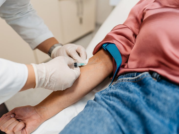 Ulcerative Colitis Antibodies: Markers, Procedure, Accuracy