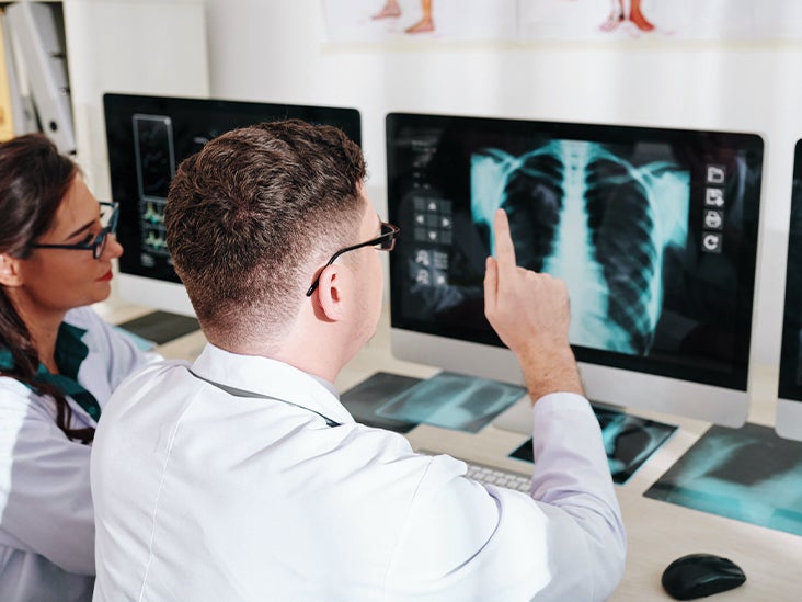 Diagnosing Acute Lymphocytic Leukemia (ALL): Blood Tests and Biopsies