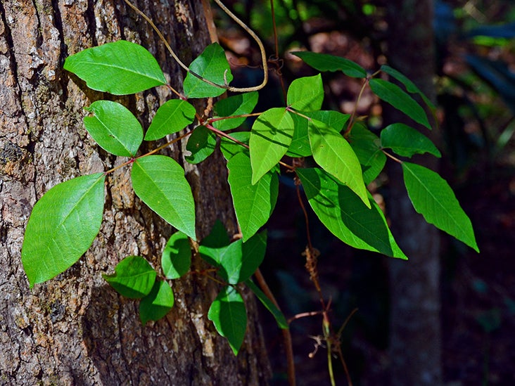 Recognizing Plants That Cause Hives or Other Reactions