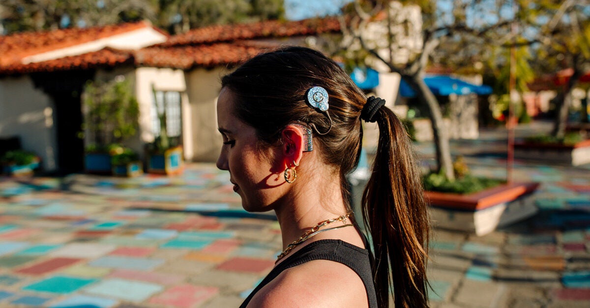 Your Guide to Rehab After Cochlear Implant