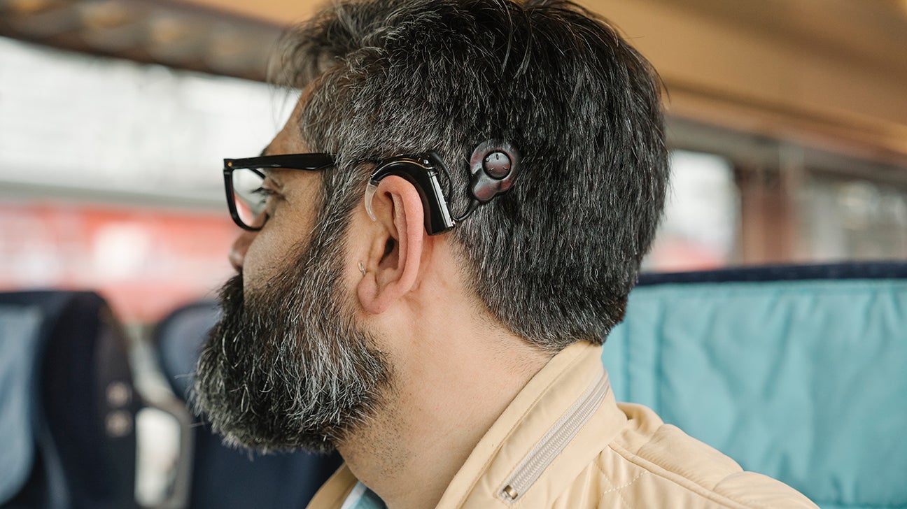 How Cochlear Implants Contribute to Hearing Fatigue