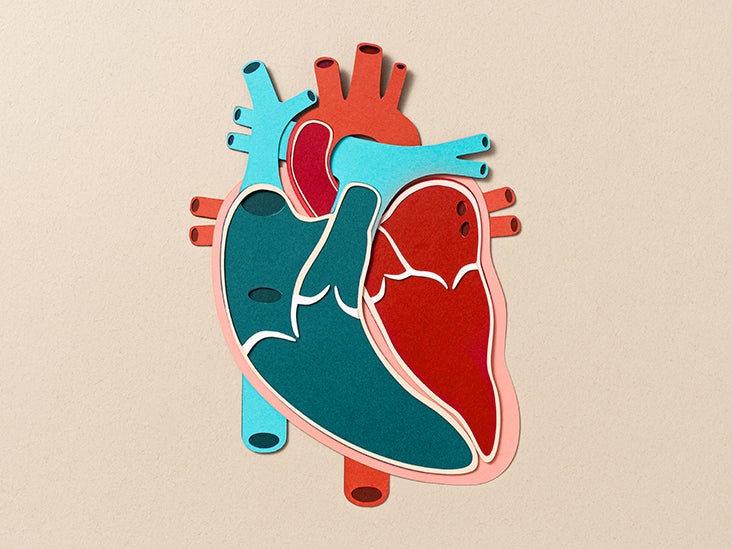 Aortic Dissection Vs Aneurysm How Do They Differ