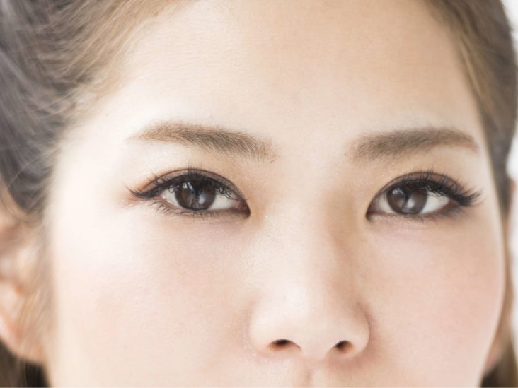 Swollen Eyelid Due To Makeup Allergy Saubhaya Makeup
