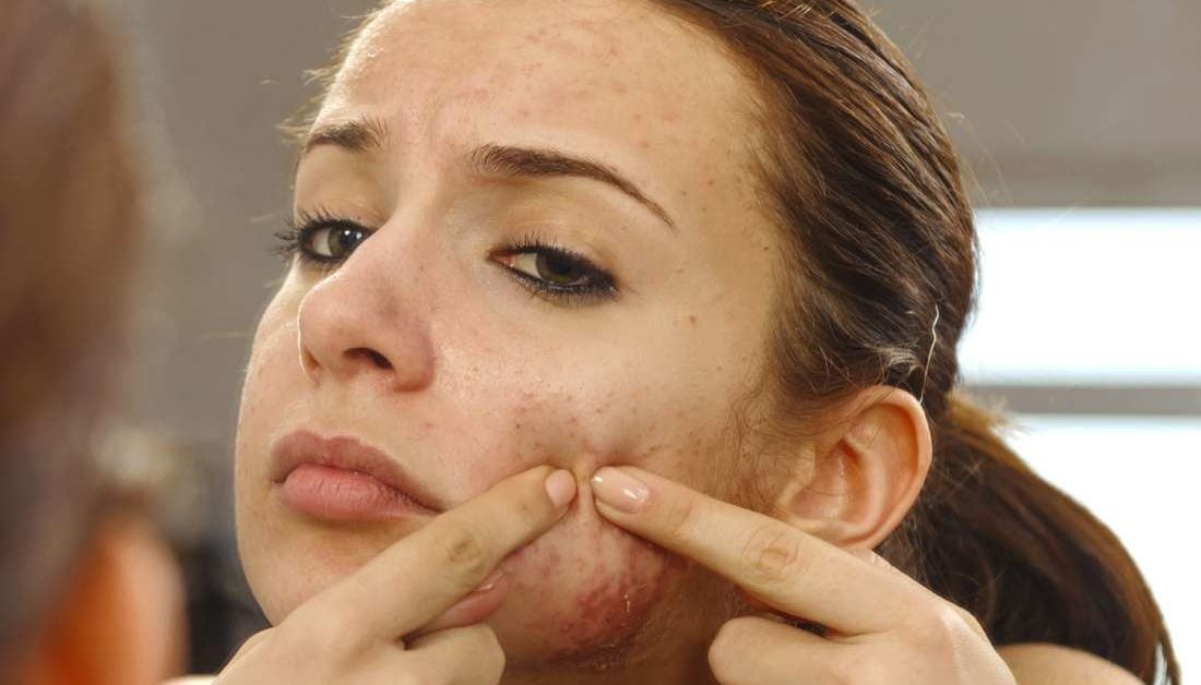 Whats The Difference Between A Pimple A Boil Heres