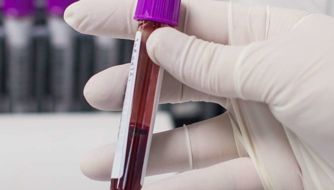 Rarest blood type: Chart and compatibility