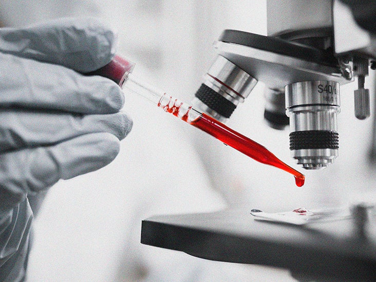 Complete blood count: Definition, purpose, results, and more